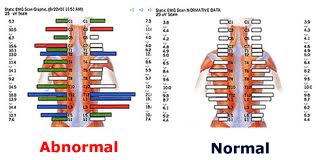 Subluxation Station | Jacksonville, TX Chiropractor | Rigsby Family ...